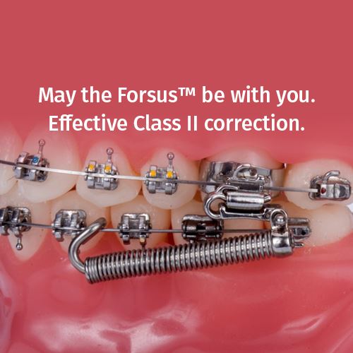 3M: "May the Forsus™ be with you: Effective Class II correction" -webinaari