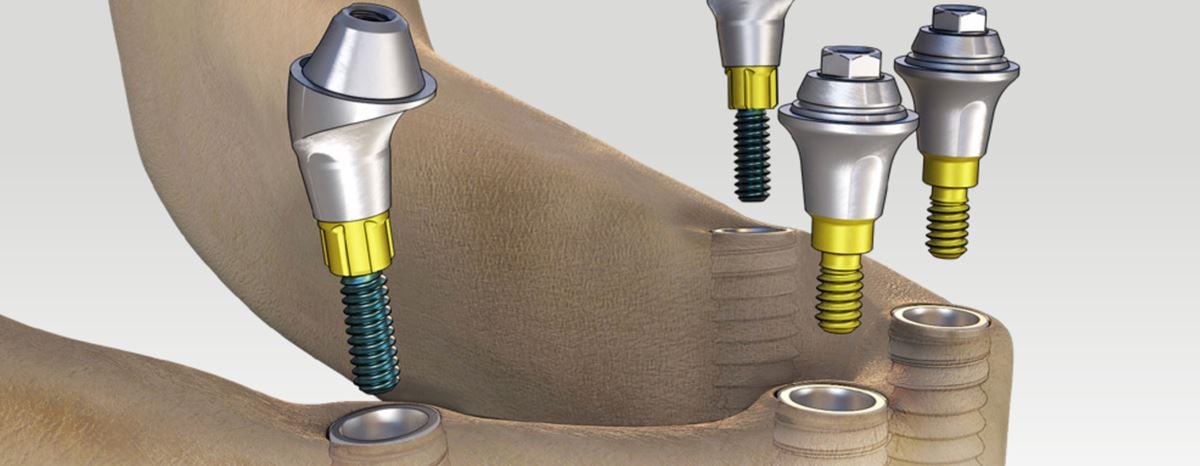 Uudistettu CONELOG® Multi-Unit -konsepti